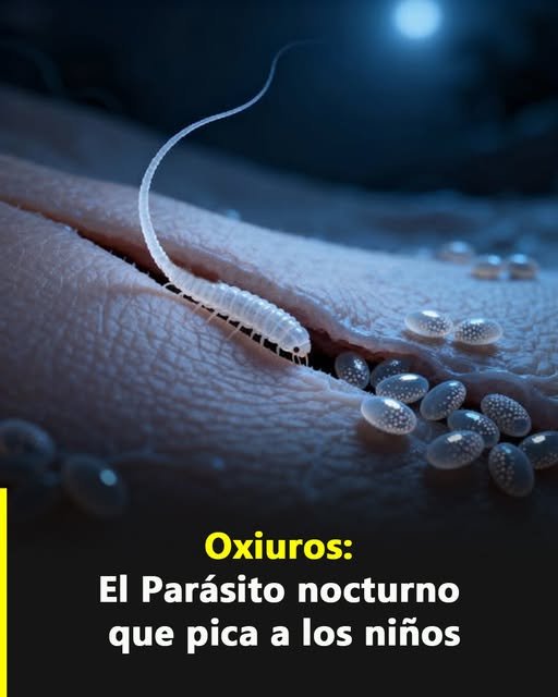Oxiuros en niños: lo que debes saber sobre este parásito frecuente y ...